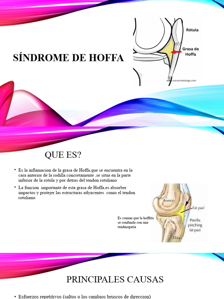 Síndrome de Hoffa | PDF