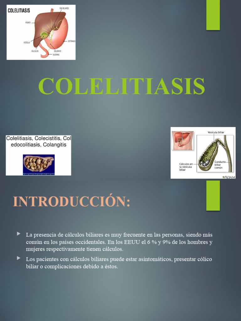 COLELITIASIS | PDF | Gastroenterología | Hígado