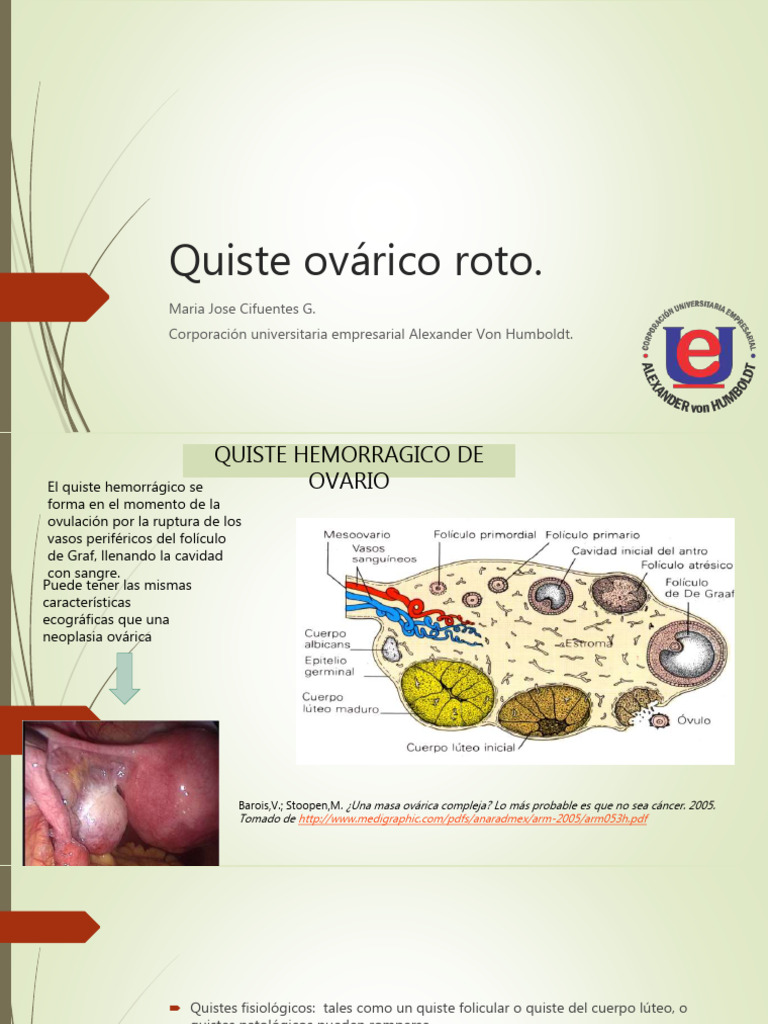 dolor pelvico agudo quiste roto-170604193359 | PDF | Ovario | Causas de la muerte