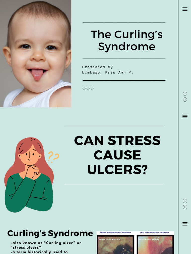 Curling Syndrome | PDF