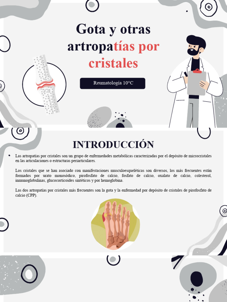 Gota y cristales de urato monosódico | PDF | Gota | Medicina CLINICA