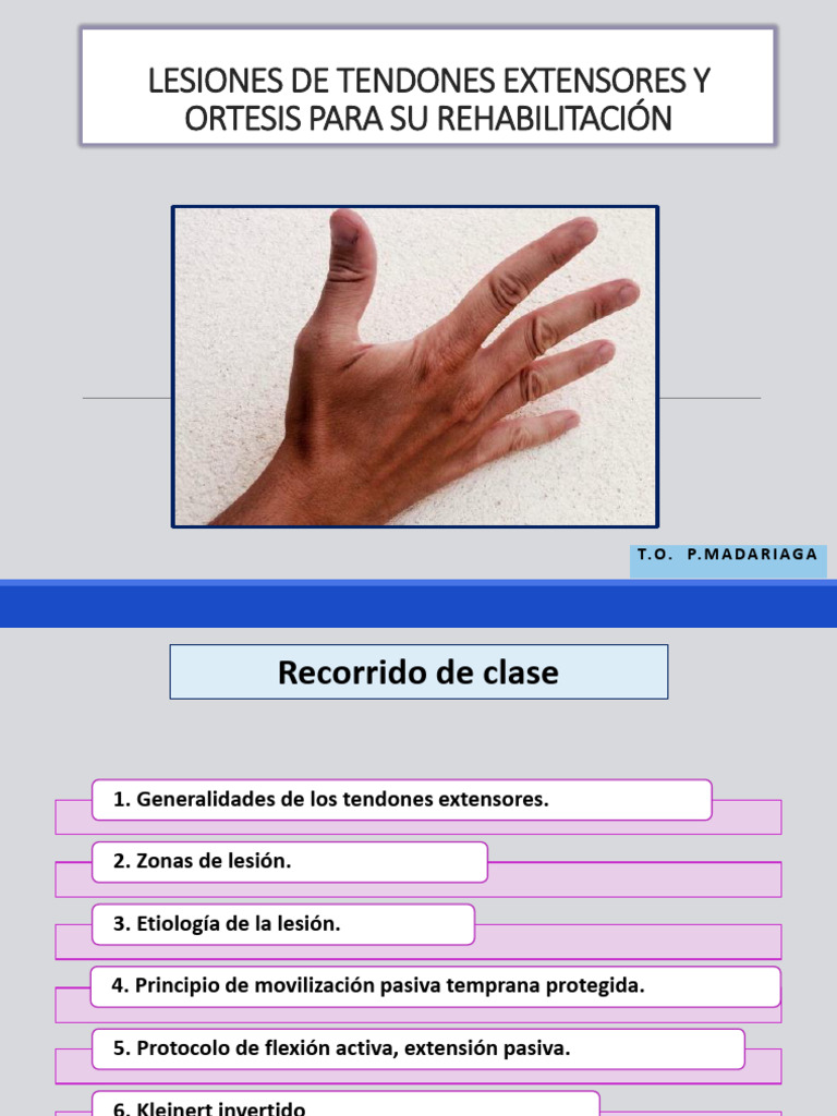 Lesion Tendones Extensores | PDF