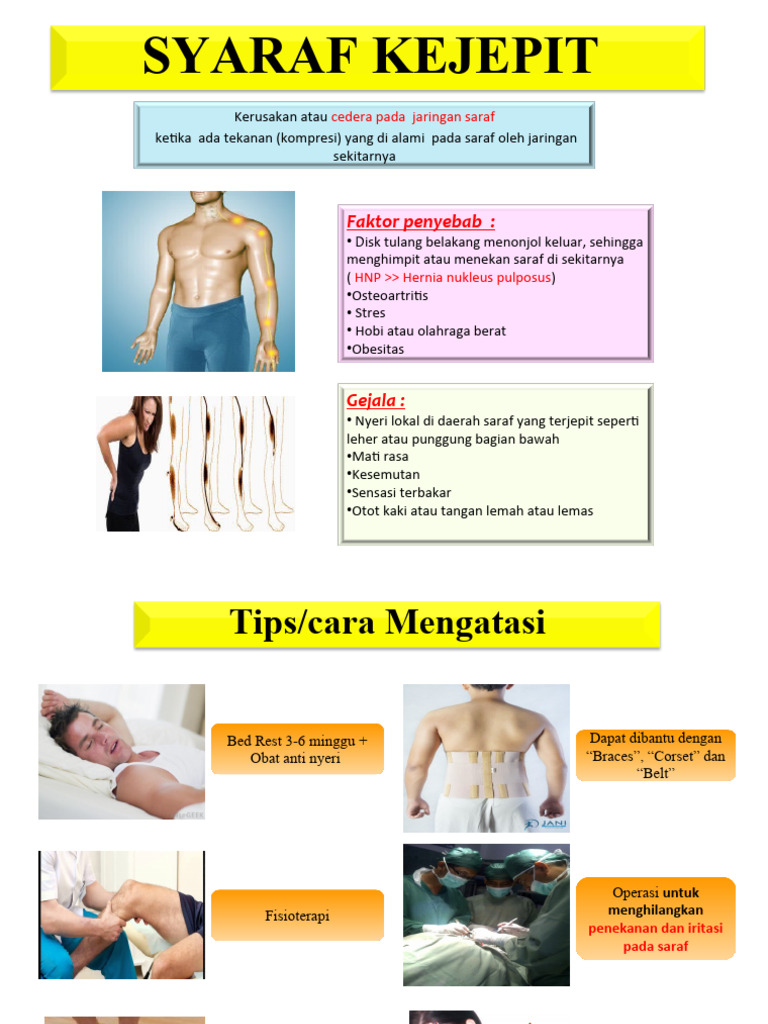 Mengatasi Syaraf Kejepit Secara Efektif | PDF