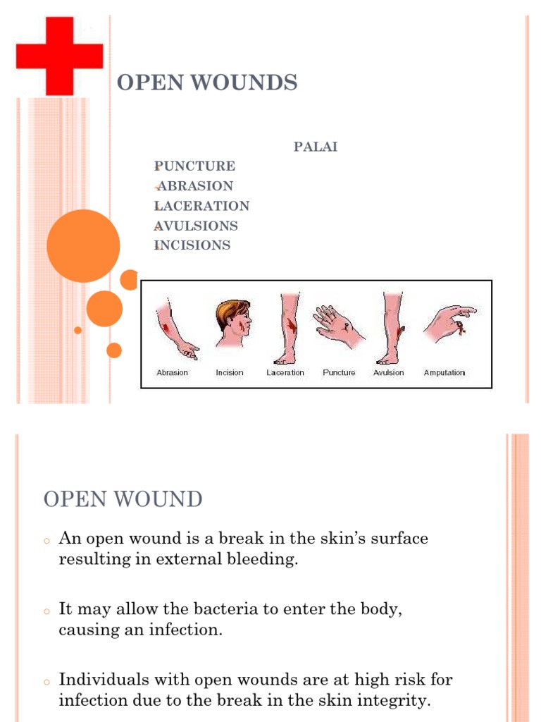 Open Wounds | PDF | Science & Mathematics
