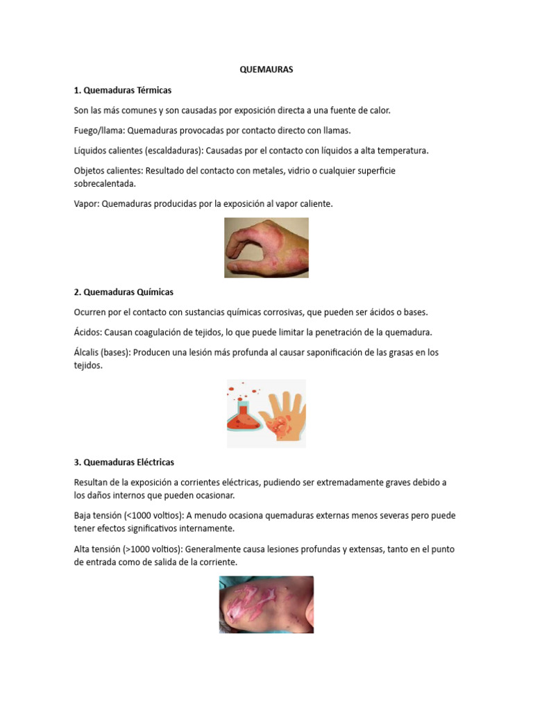 Tipos de Quemaduras y Sus Causas | PDF
