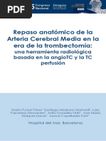 Escala ASPECTS | PDF