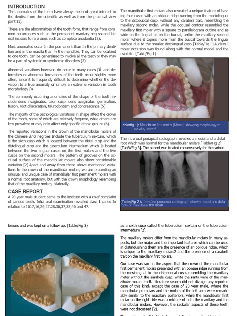 Anomalies of Mandibular first molar1 | PDF | Human Anatomy | Health ...