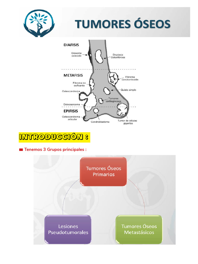 Tumores Oseos | Descargar gratis PDF | Cáncer | Neoplasias
