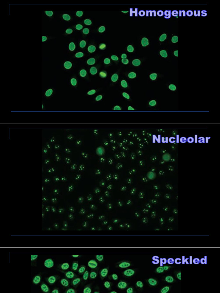 Immunofluorescence Patterns | PDF