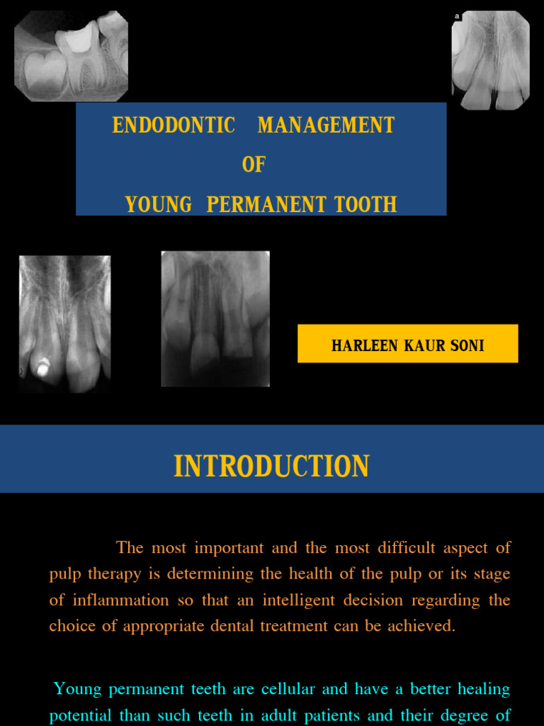 Pulp Therapy For Young Permanent Teeth | PDF | Clinical Medicine ...