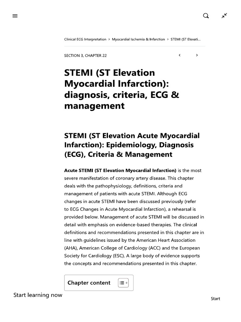 Management of STEMI | PDF