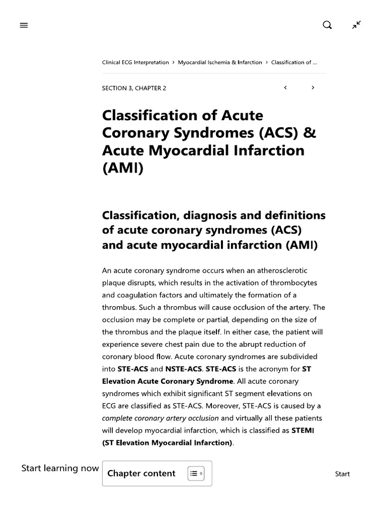 Classification of ACS | PDF