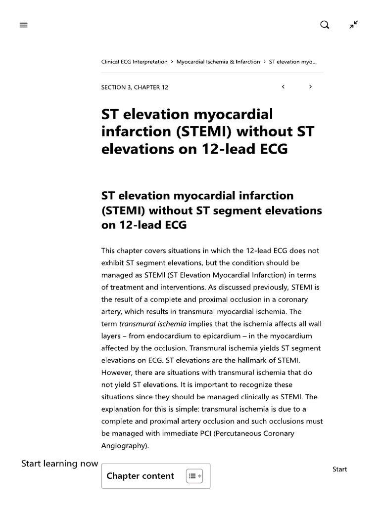 Posterior & Right Ventricular Infarct | PDF