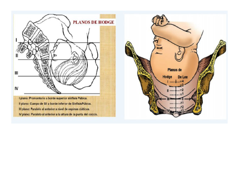 Planos Hodge | PDF