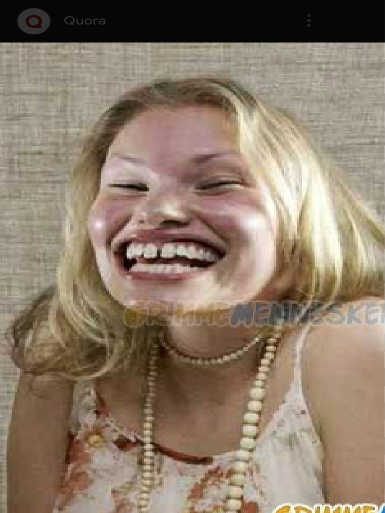 Ugliest Blonde Person in the World - Google Search | PDF