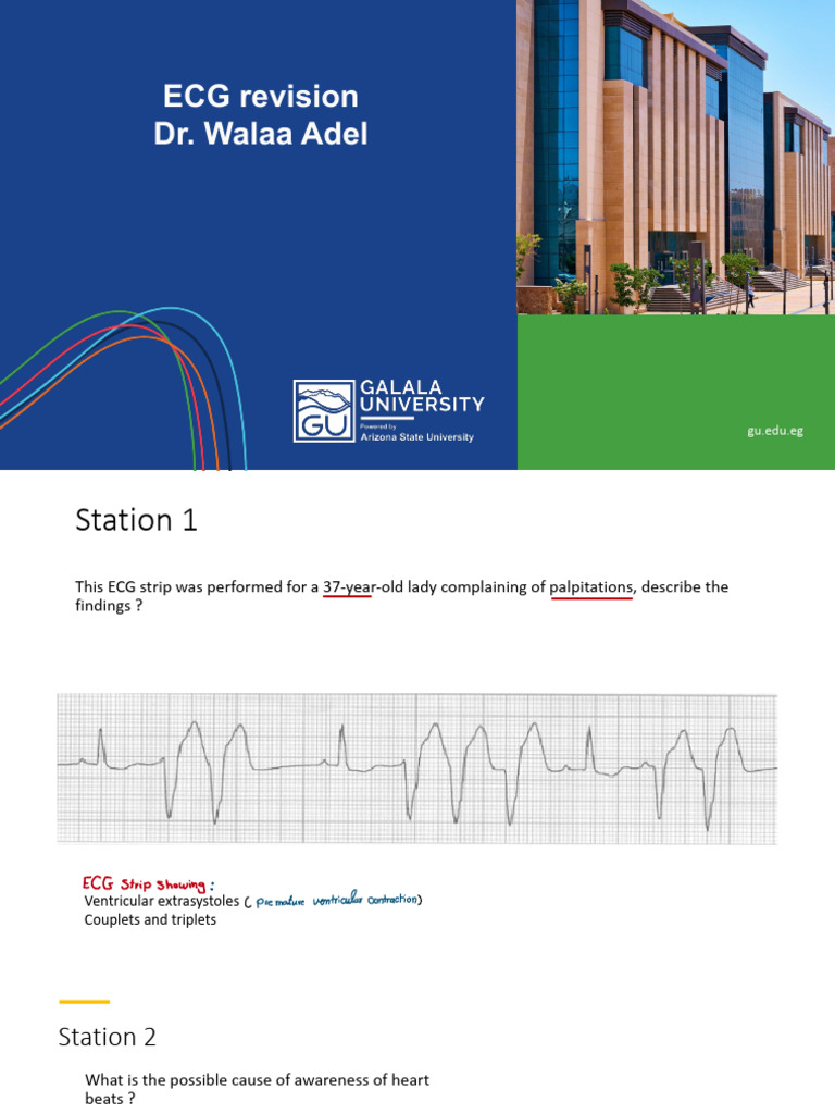 ECG revision | PDF | Electrocardiography | Cardiovascular Diseases