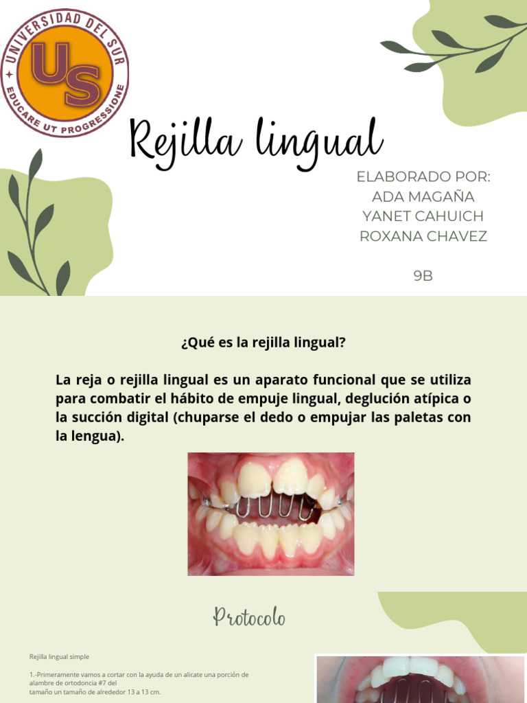 Rejilla Lingual: Tipos y Funciones | PDF