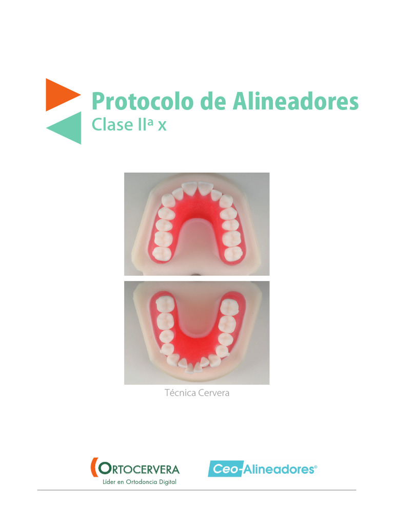 Protocolo de Alineadores Clase 2 Grado Leve | PDF | Odontología