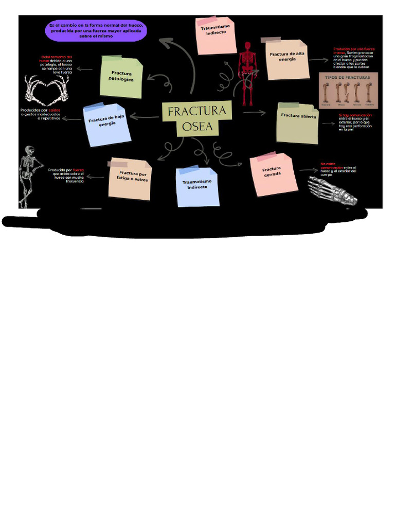 FRACTURA MAPA MENTAL | PDF FRACTURA MAPA MENTAL | PDF