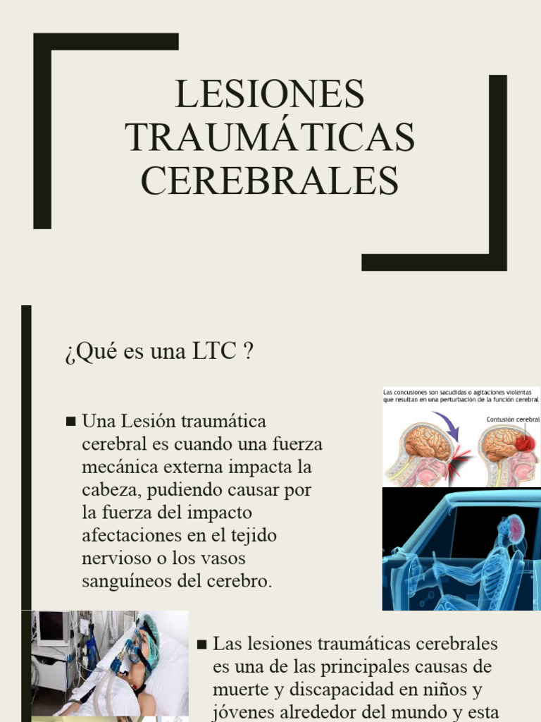 Lesiones Traumáticas Cerebrales Expo | PDF | Medicina CLINICA | Causas ...