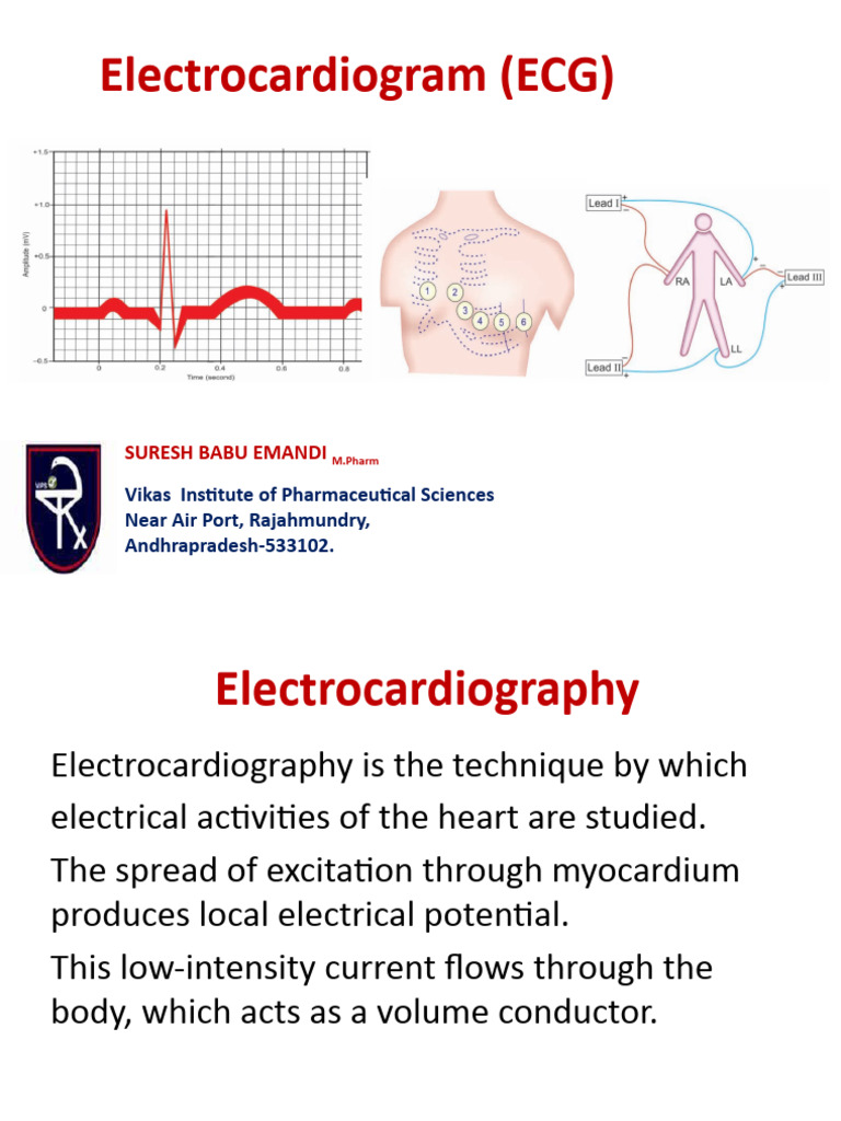 Understanding Electrocardiograms (ECG) | PDF | Electrocardiography ...