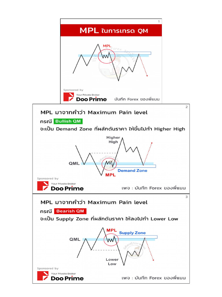 MPL (Maximum Pain Level) | PDF