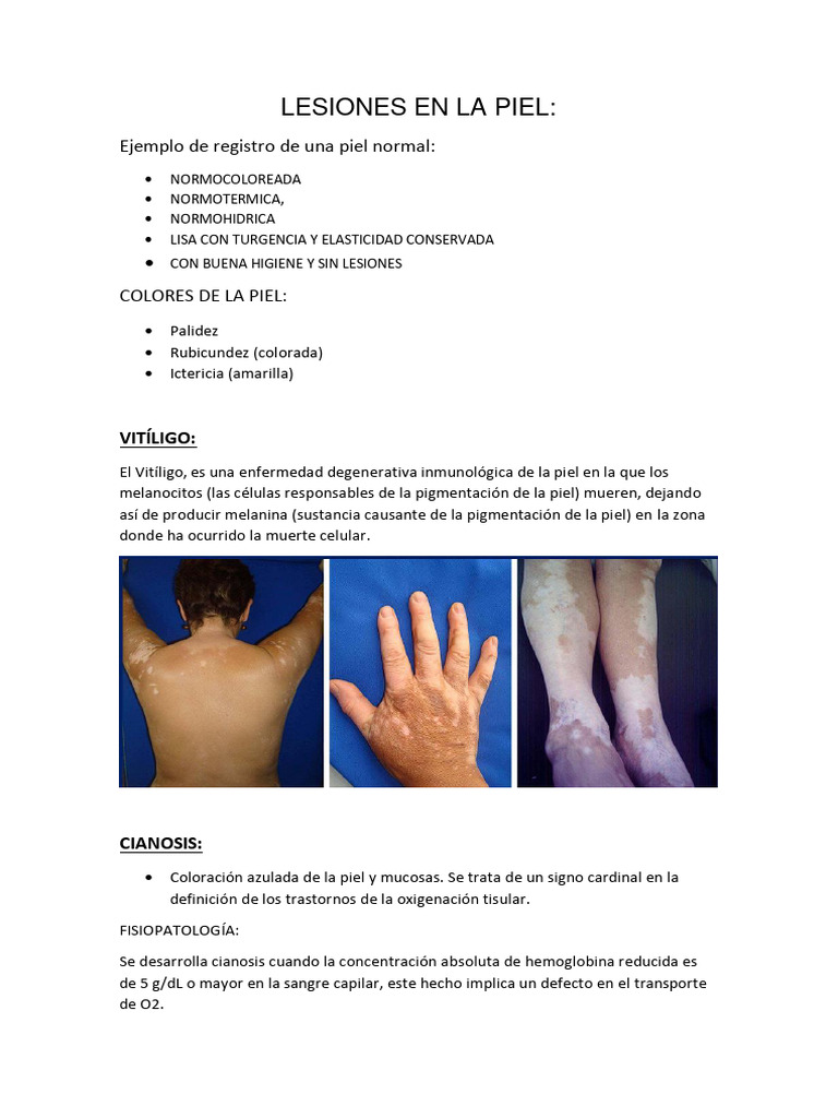 Lesiones en La Piel PDF | PDF | Edema | Especialidades Medicas