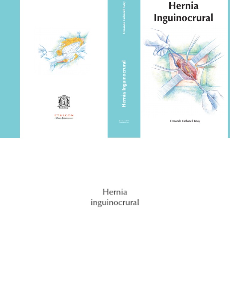 Libro de Hernia Inguinal | PDF | Cirugía | Medicina