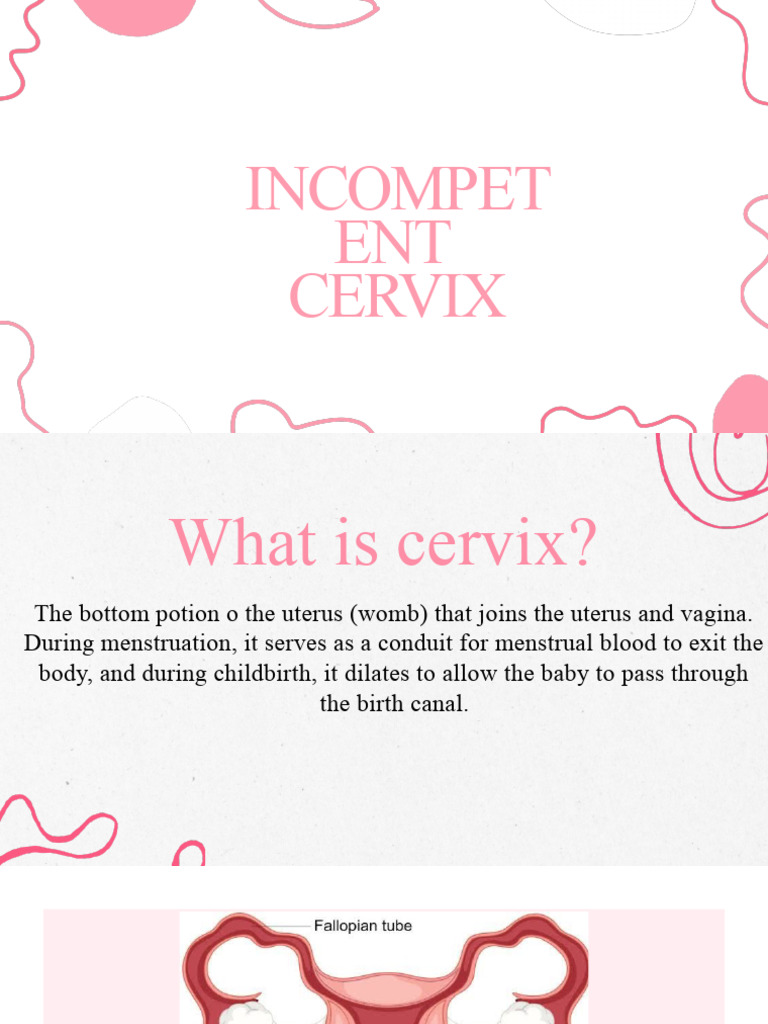 Incompetent Cervix Group 4 | PDF | Miscarriage | Pregnancy