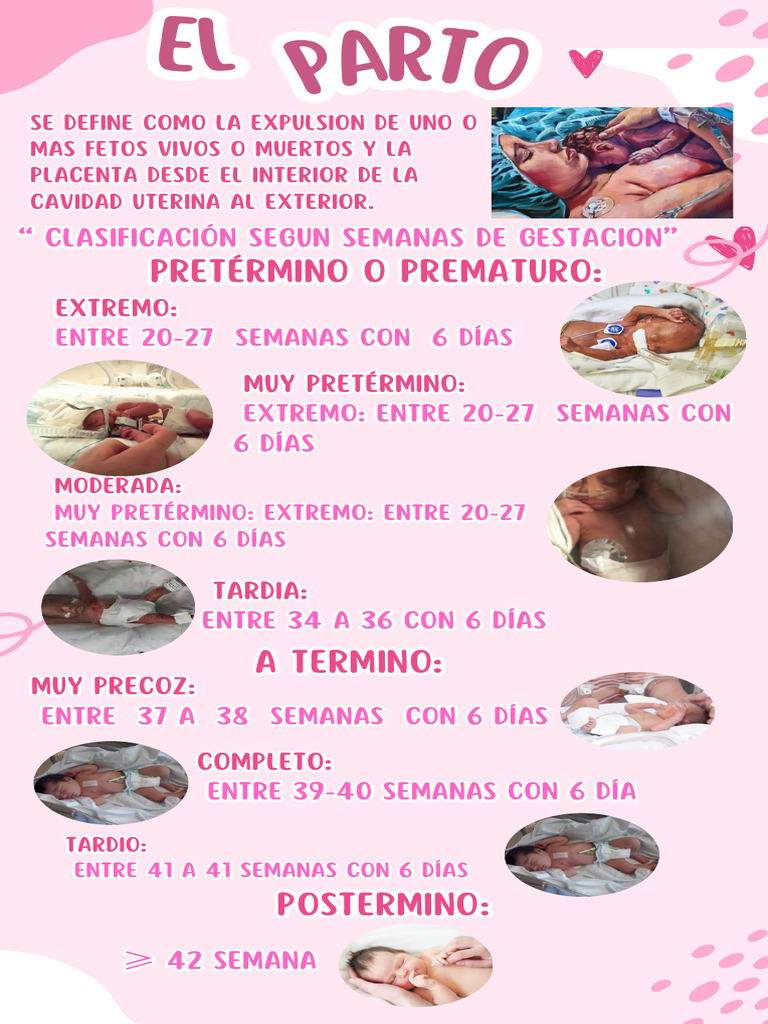 Parto Infografia | PDF | Parto | Parto prematuro
