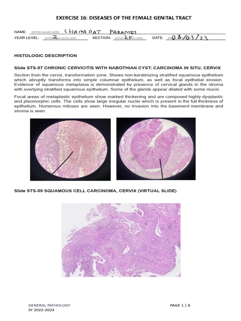 Chaiyarat Parames 2200084. 08.03.2023 | PDF | Epithelium | Ovarian Cancer