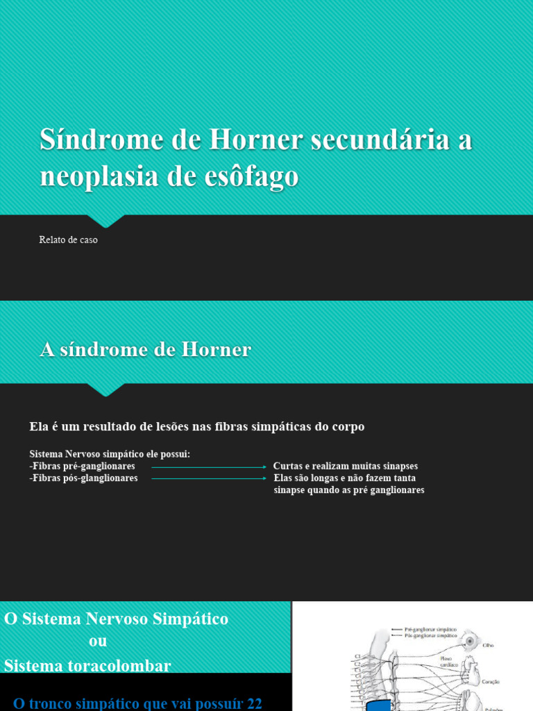 Síndrome de Horner | PDF | Nervo | Medula espinhal