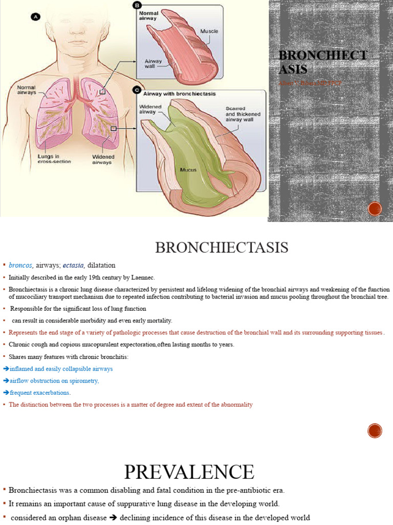 Bronchiectasis | PDF | Clinical Medicine | Epidemiology