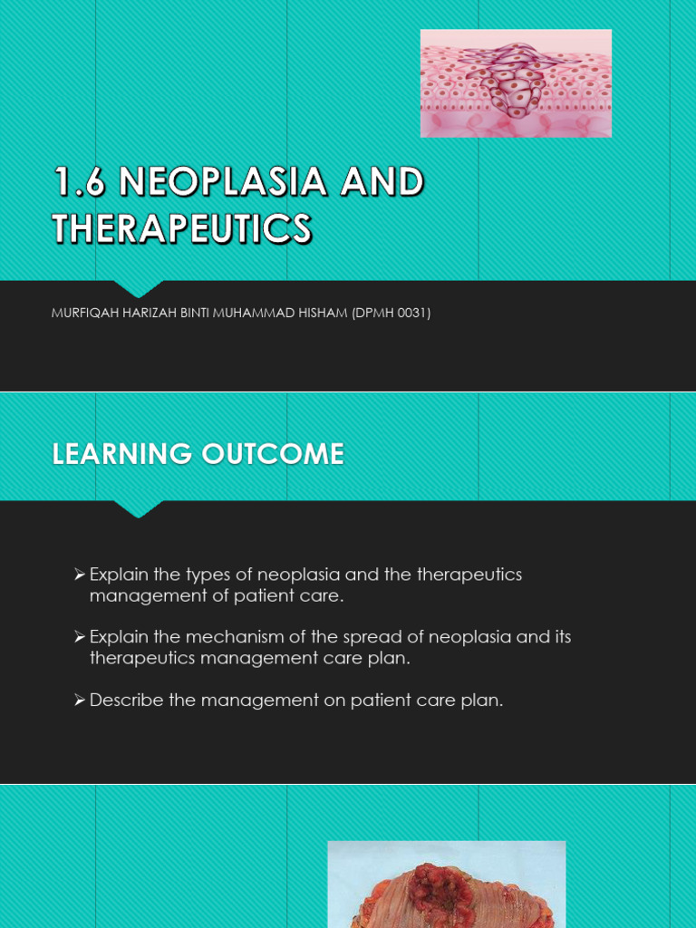 1.6 Neoplasia and Therapeutics | PDF