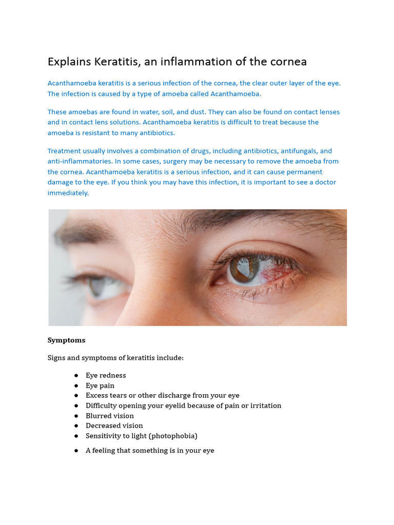 Explains Keratitis - An Inflammation of The Cornea | PDF | Contact Lens ...