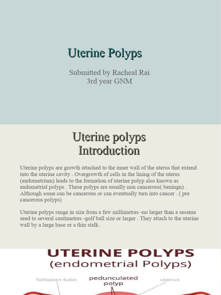 Uterine Polyps: Diagnosis and Treatment | PDF | Uterus | Anatomy