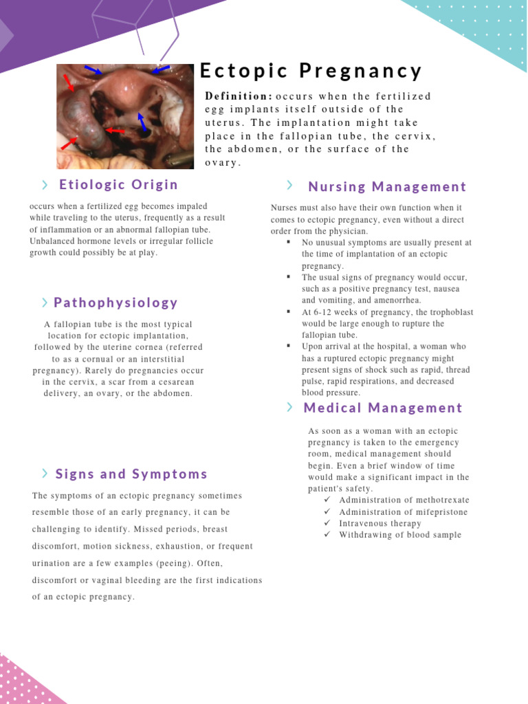 Ectopic Pregnancy | PDF