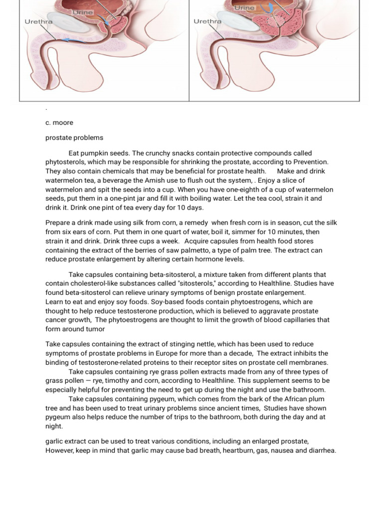Prostate Problems | PDF | Prostate | Medical Specialties