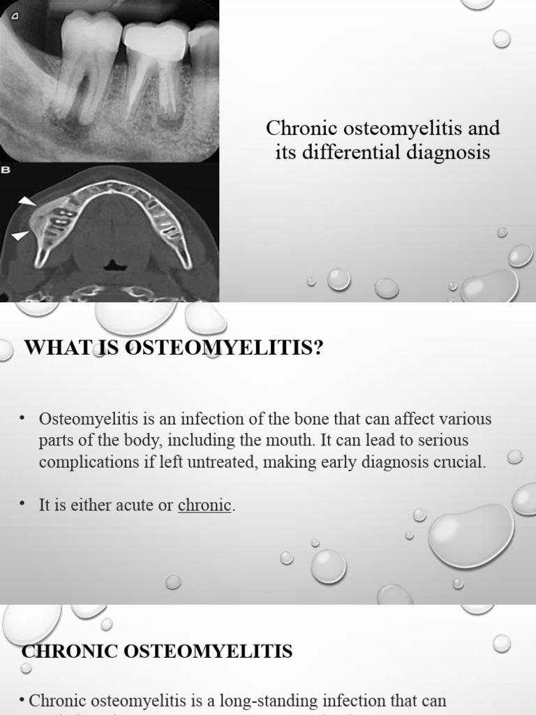 Chronic Osteomyelitis Overview and Diagnosis | PDF | Medicine ...