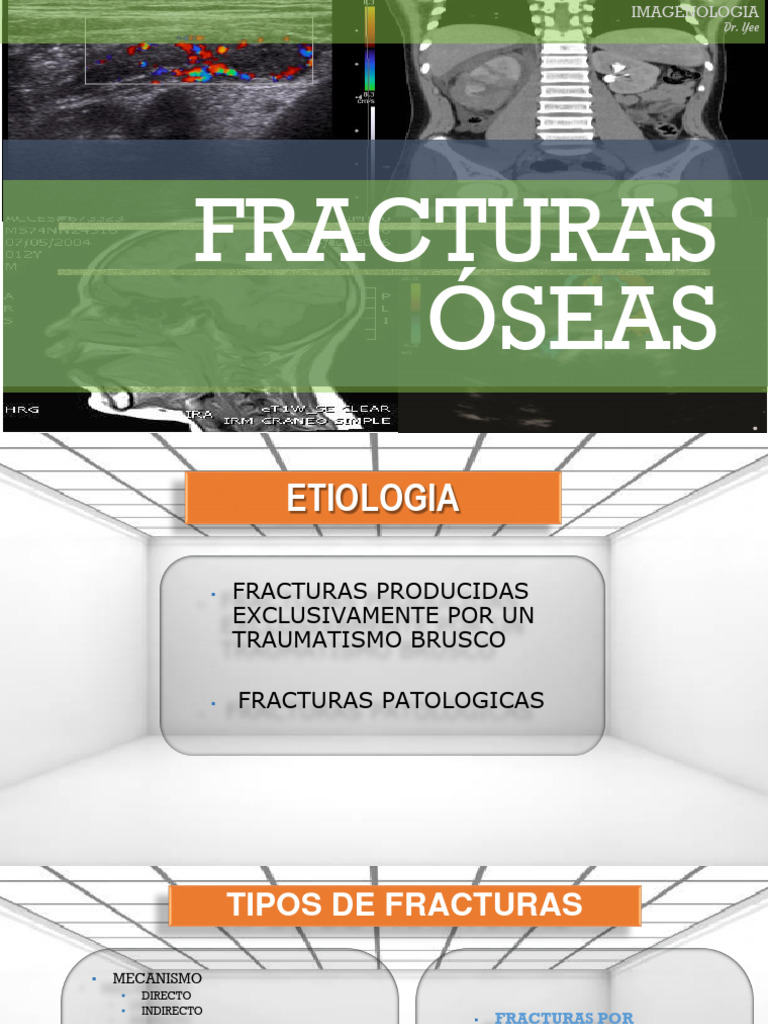 1 Fracturas óseas | PDF | Hueso | Imagenes medicas