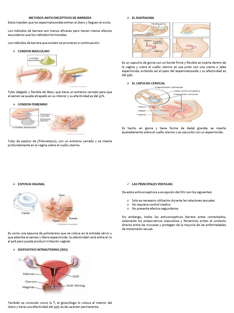 METODOS ANTICONCEPTIVOS DE BARRERA | PDF | Control de la natalidad | Condón