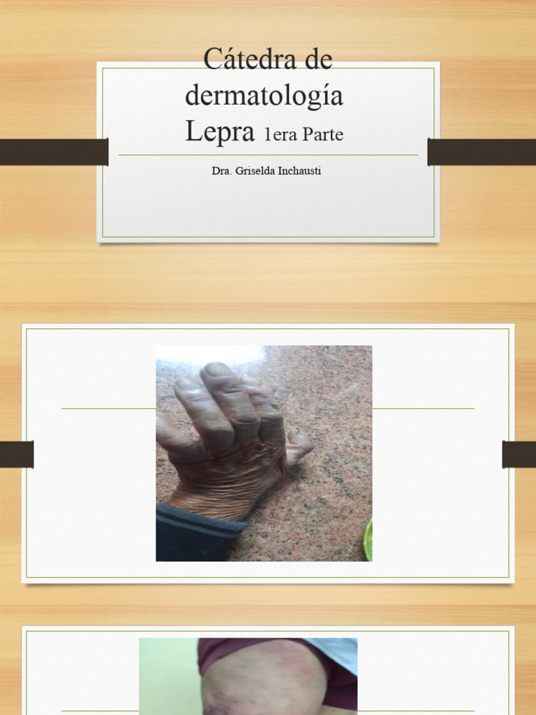 Lepra | PDF | Nervio | Especialidades Medicas