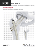 Surgical Technique Guide - RFN-ADVANCED Retrograde Femoral Nailing ...