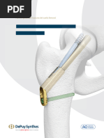 Surgical Technique Guide-Tibial Nail Advanced System Infrapatellar | PDF