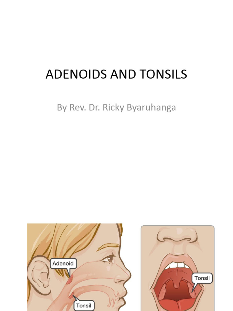 ADENOIDS AND TONSILS | PDF | Animal Physiology | Human Diseases And ...