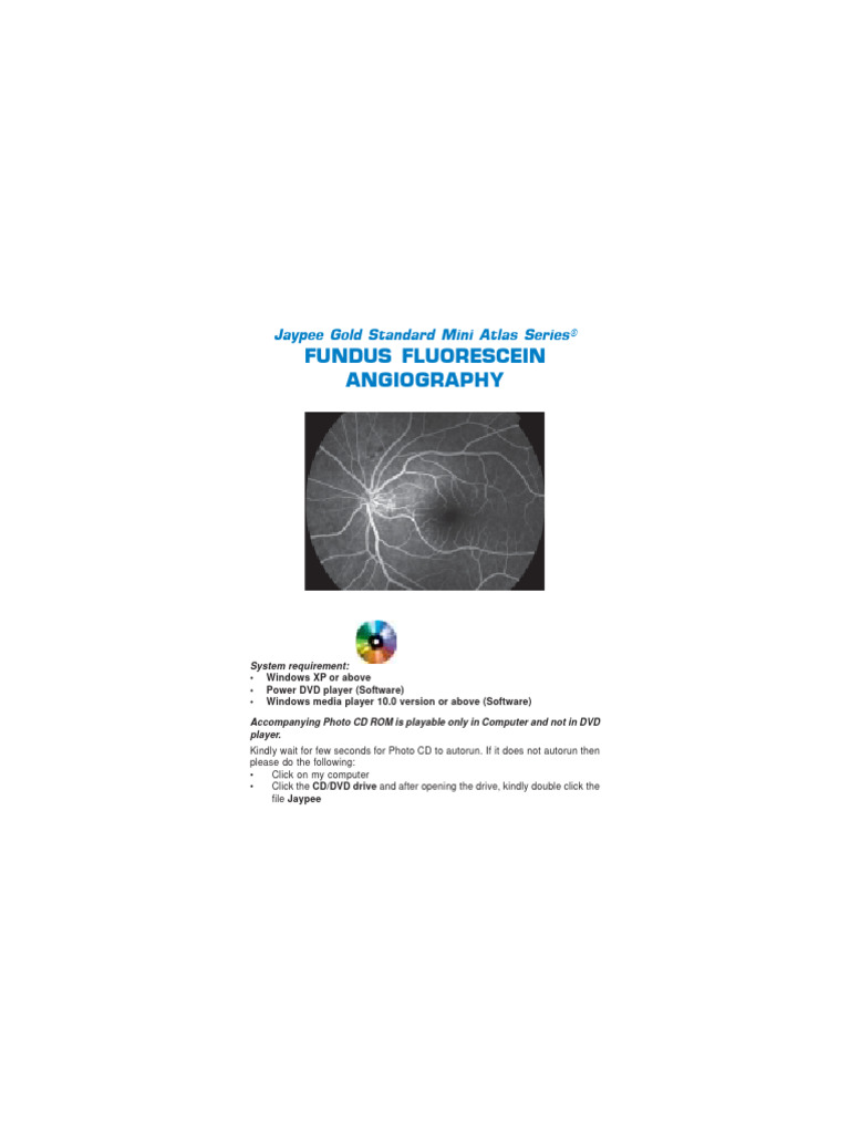 Mini Atlas Series- Fundus Fluorescein Angiography | PDF | Angiography | Retina