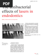 Infected and Affected Dentin KD | PDF | Dentin | Human Tooth