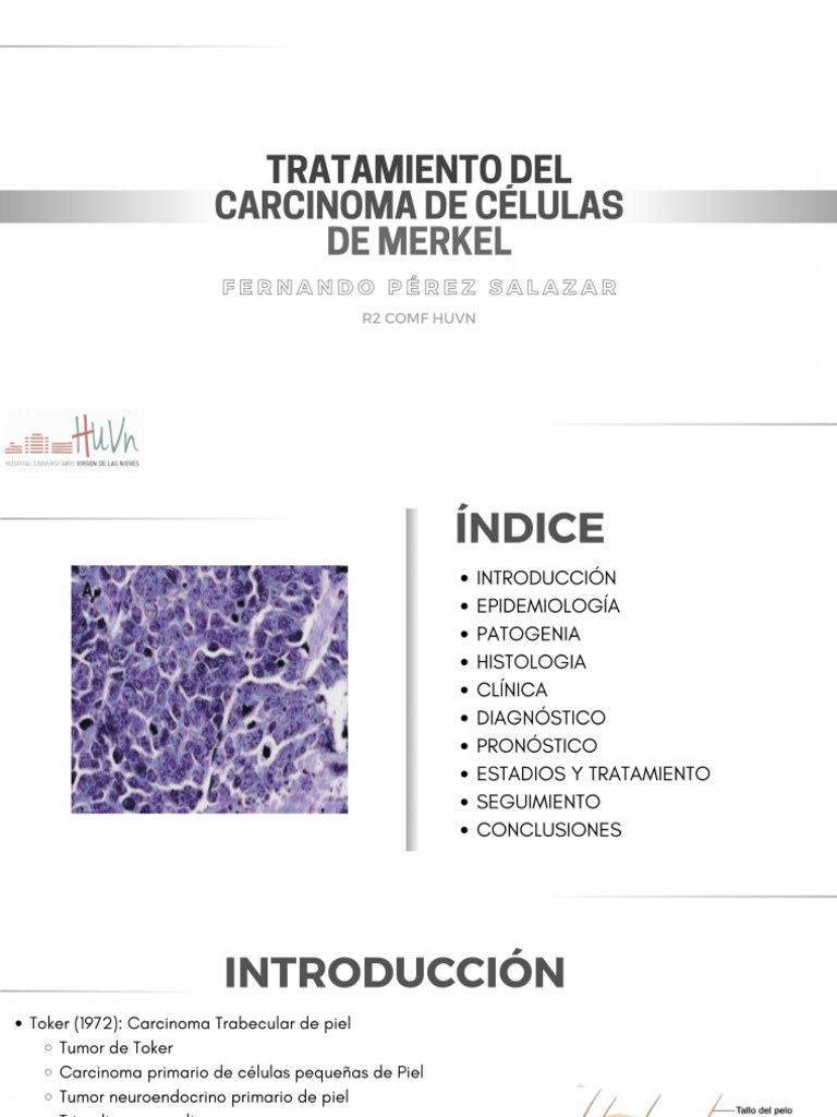Carcinoma Celulas de Merkel | PDF