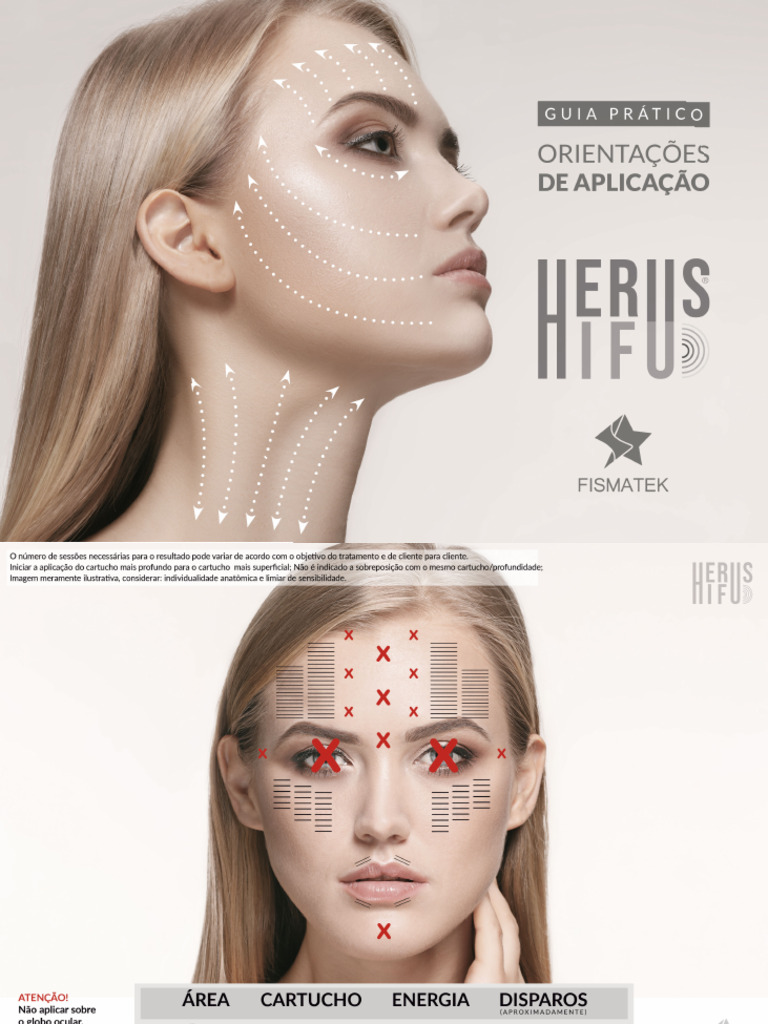 Guia Prático - Orientação de Marcações - Herus HIFU CONVENCIONAL | PDF