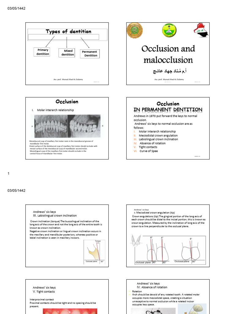 Occlusion and Malocclusion: Types of Dentition | PDF | Tooth | Mouth
